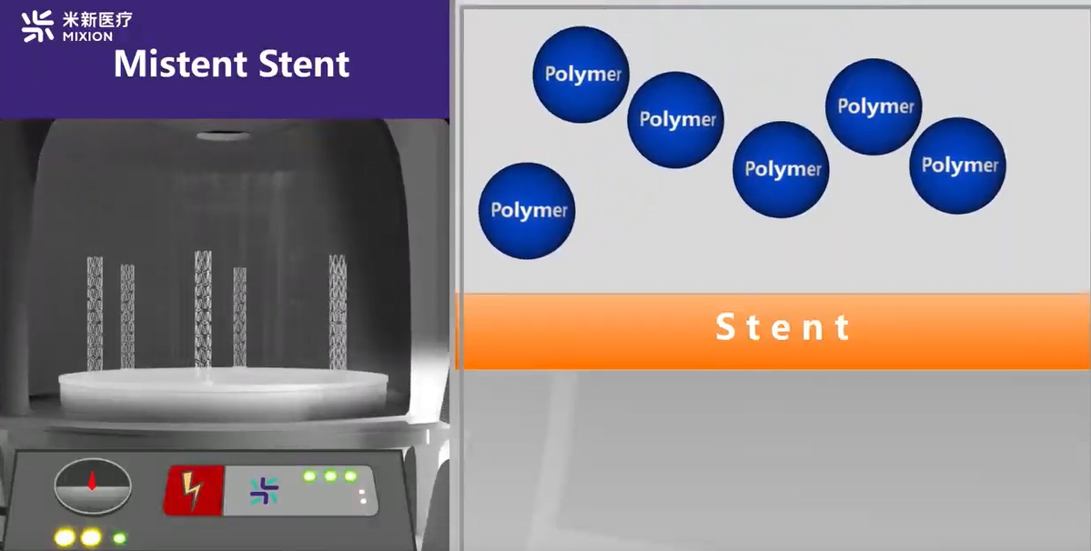 Mistent Stent Coating Process - I Hot New